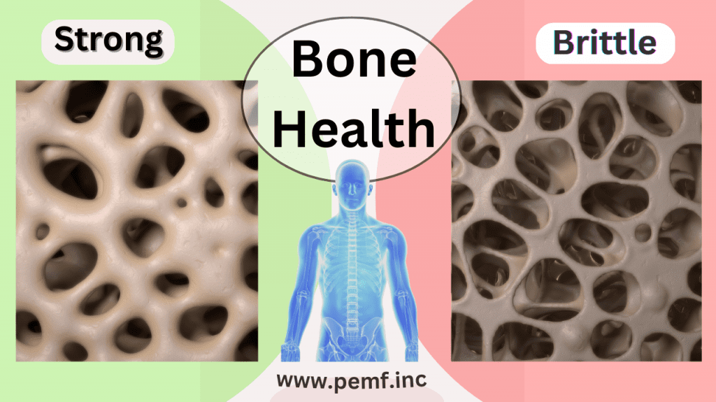 Improving Your Bone Density Through PEMF Therapy Machines